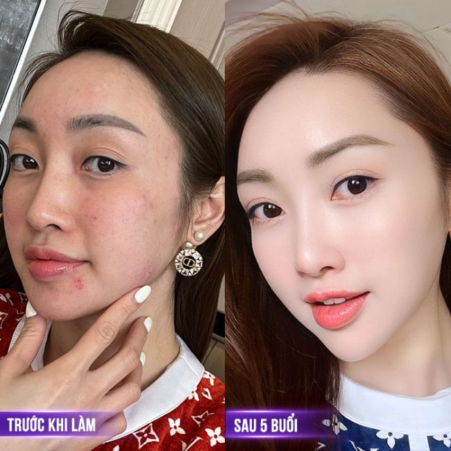 Viện thẩm mỹ Lavender By Chang - Top 1 Thẩm mỹ công nghệ cao